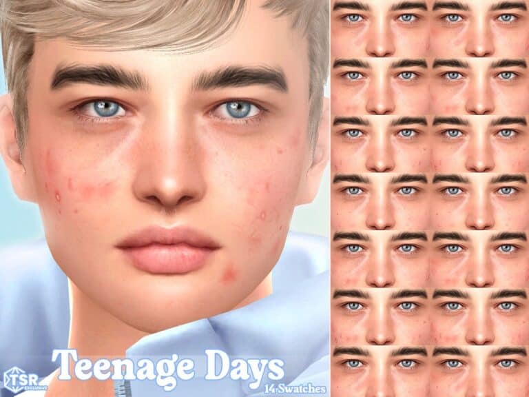 22+ Best Sims 4 Acne CC and Mods: Realistic Overlays, Breakouts, and ...