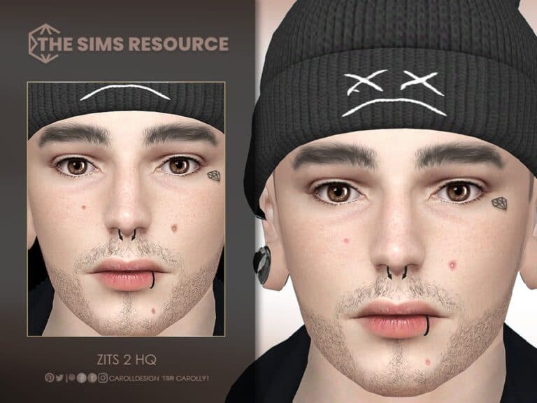 22+ Best Sims 4 Acne CC and Mods: Realistic Overlays, Breakouts, and ...