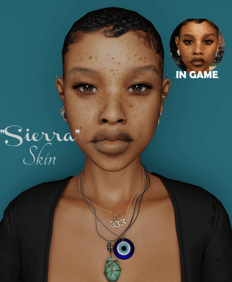 22+ Best Sims 4 Acne CC and Mods: Realistic Overlays, Breakouts, and ...