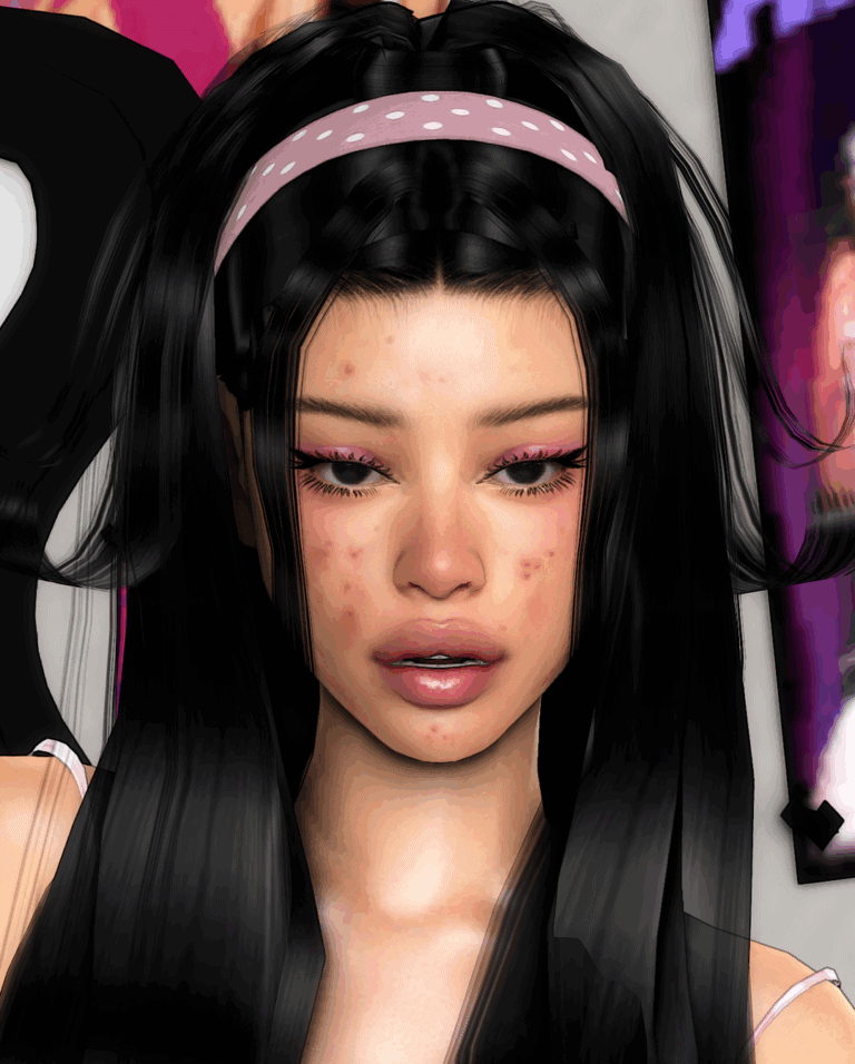 22+ Best Sims 4 Acne CC and Mods: Realistic Overlays, Breakouts, and ...